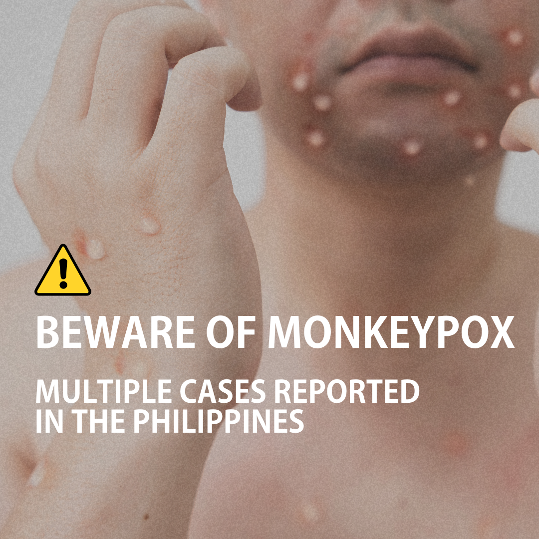 Beware of Monkeypox! Multiple cases reported in the Philippines ...